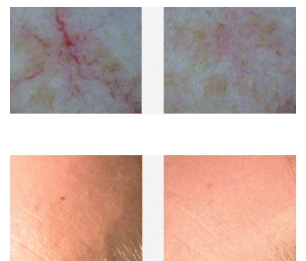 Blixt Laser Clinic Lycksele - TimeCenter